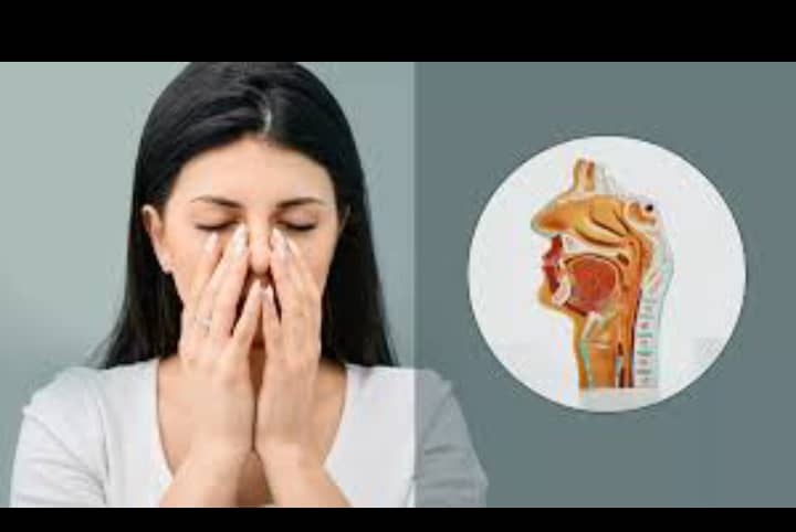 RDC-Santé : La sinusite, ses causes et son traitement - 24 Critiques